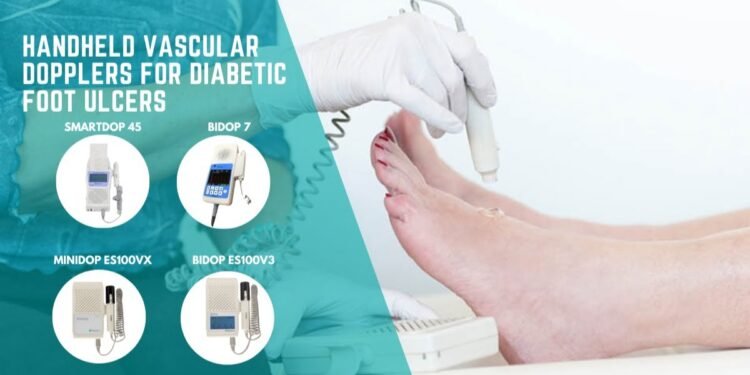 How Handheld Vascular Dopplers Improve Diabetic Foot Ulcer Diagnosis ...